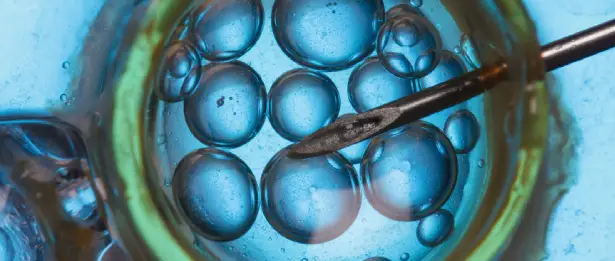 Fertilization Failure - Liv Editorial Board